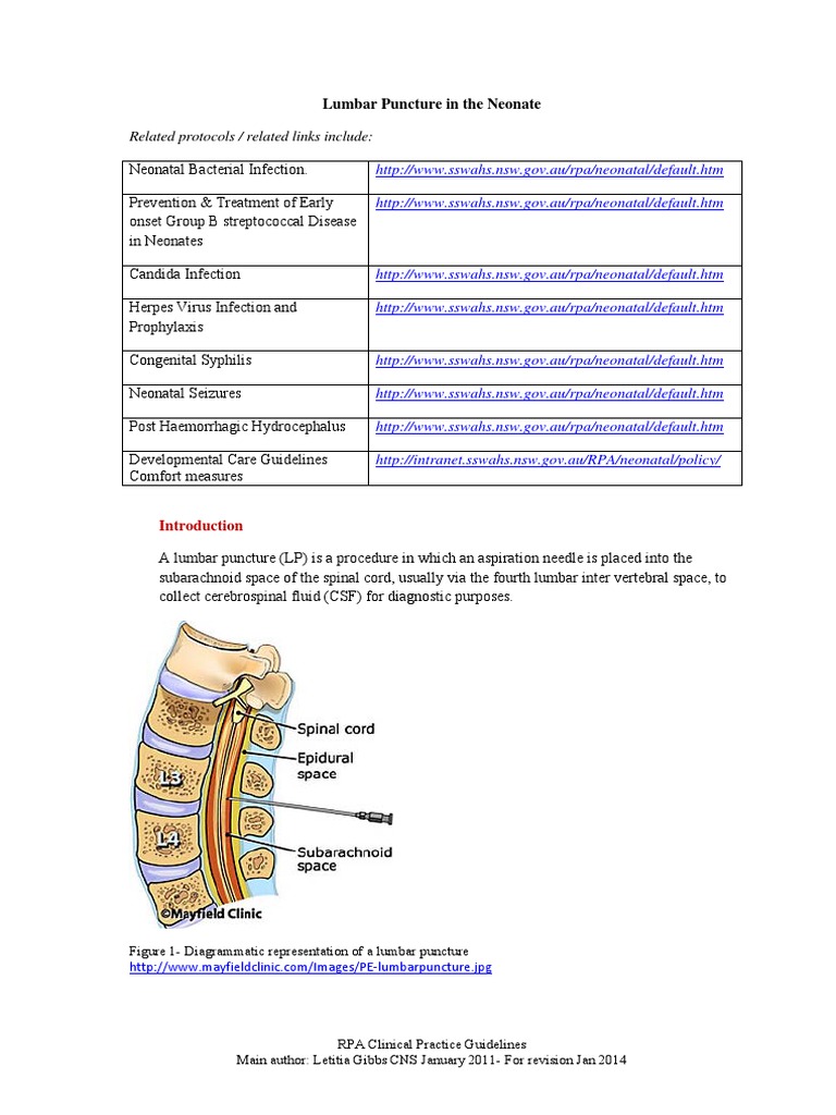 Lumbar Puncture | PDF | Meningitis | Spinal Cord