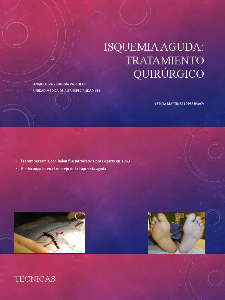 Isquemia Aguda Manejo QX | PDF | Trombo | Rodilla