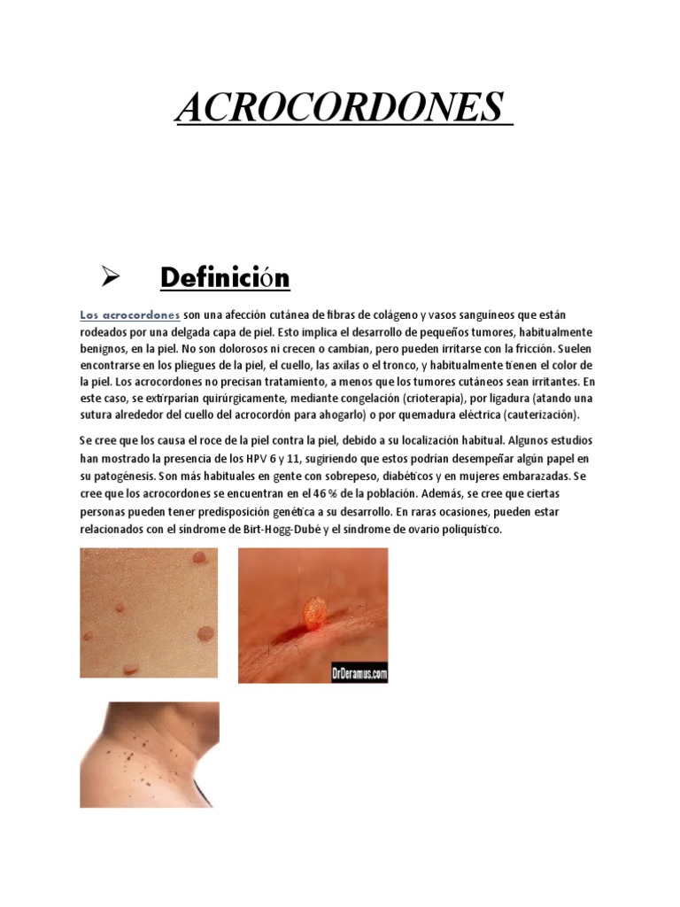 Acrocordones 1°farmacia | PDF