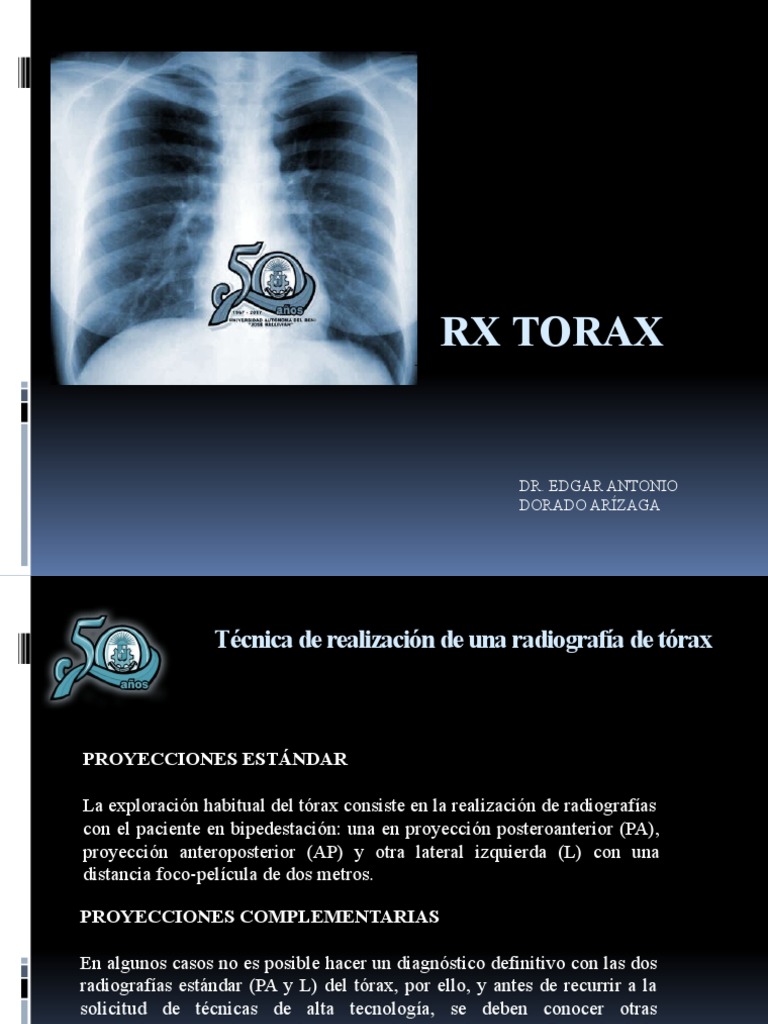RX Torax | PDF | Tórax | Pulmón