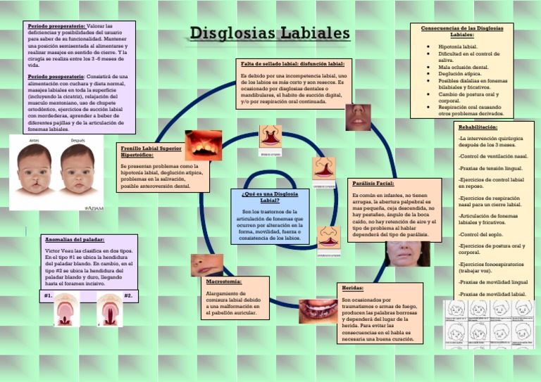 Disglosias Labiales: Causas y Tratamientos | PDF | Medicina | Medicina ...