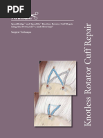 Knee FiberTak Anchor System Overview | PDF | Surgical Suture | Knee