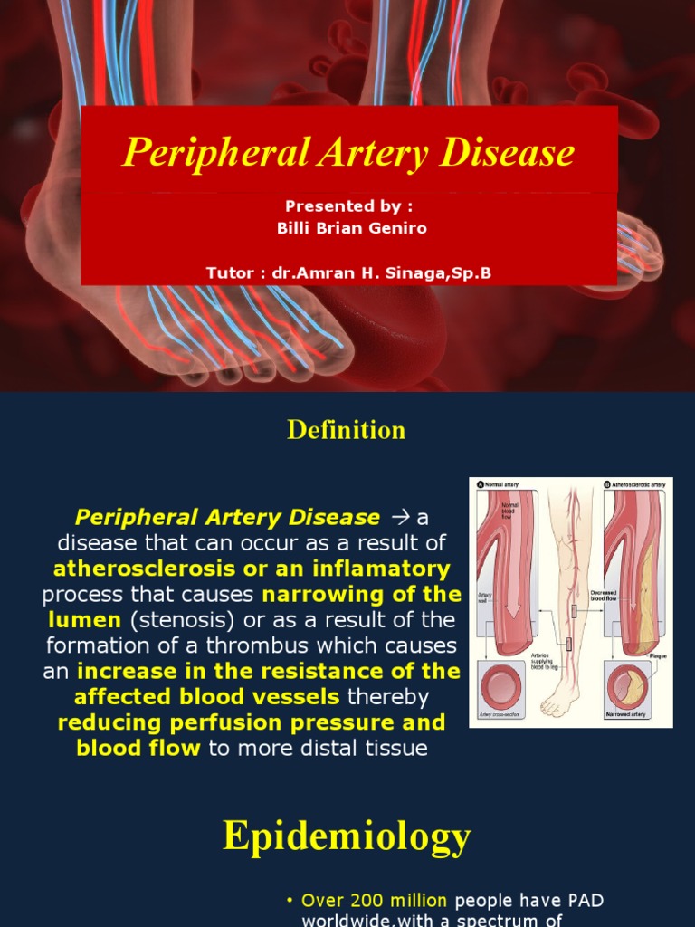 Crs Peripheral Artery Disease - Billi Brian Geniro | PDF ...