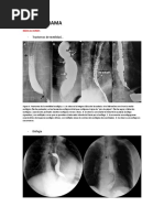 Niveles Axilares de Berg | PDF | Finanzas y dinero