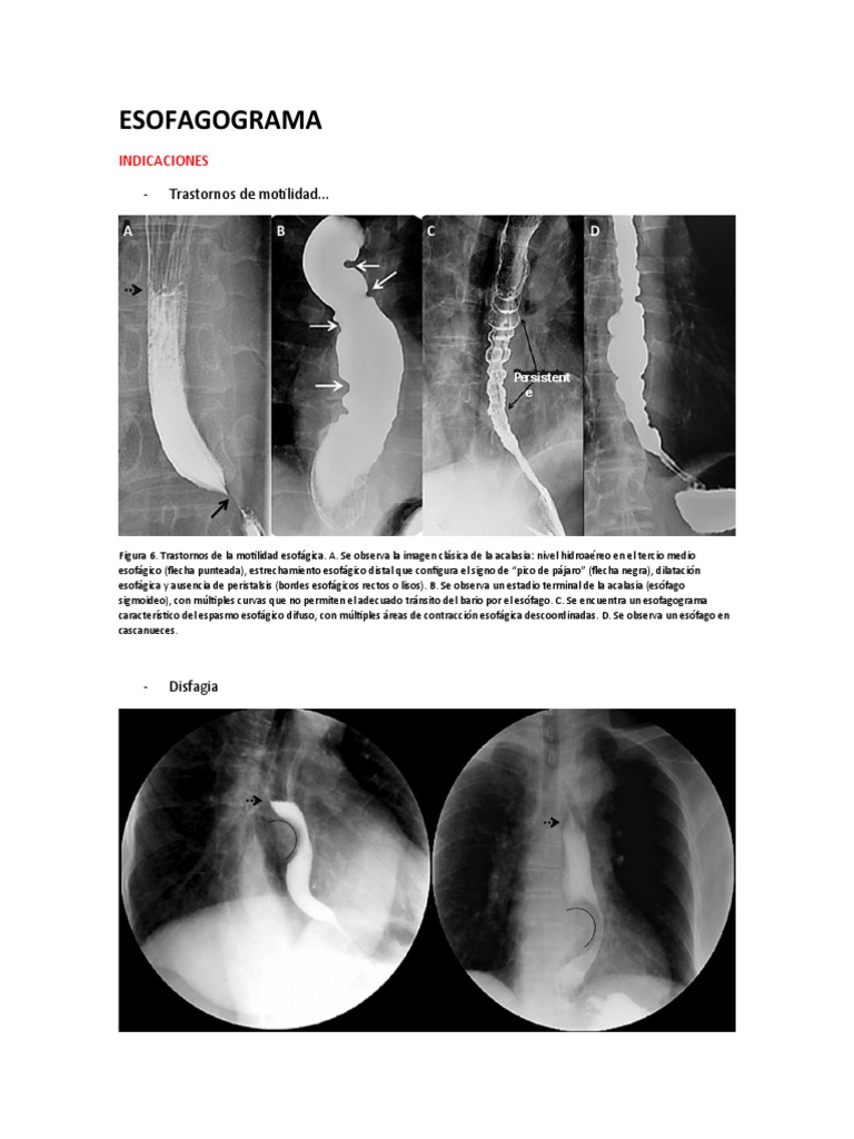 Esofagograma | PDF | Estómago | Enfermedades y trastornos