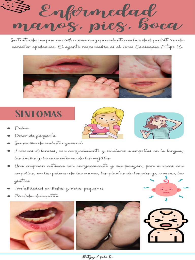 Enfermedad Manos, Pies, Boca | PDF