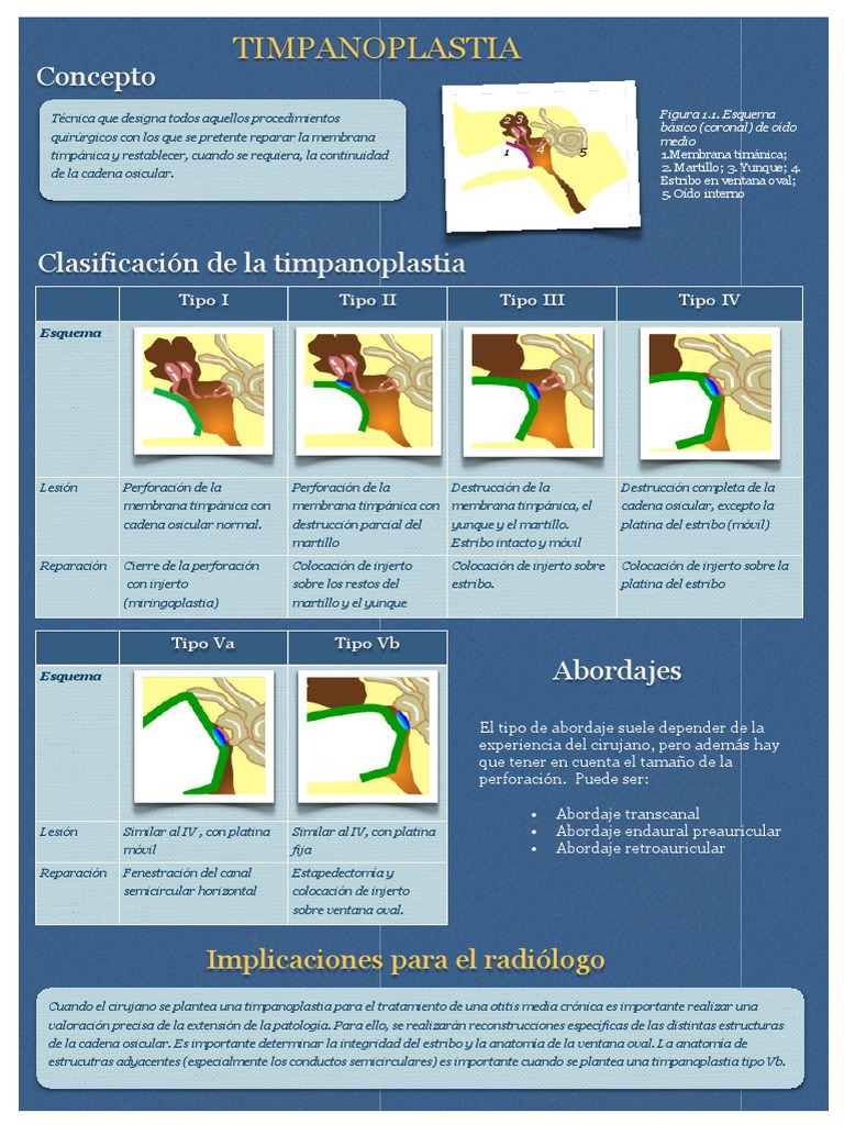 Reparación de la membrana timpánica: clasificación y técnicas ...