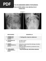 Principales Signos Abdominales | PDF | Tracto gastrointestinal | Abdomen