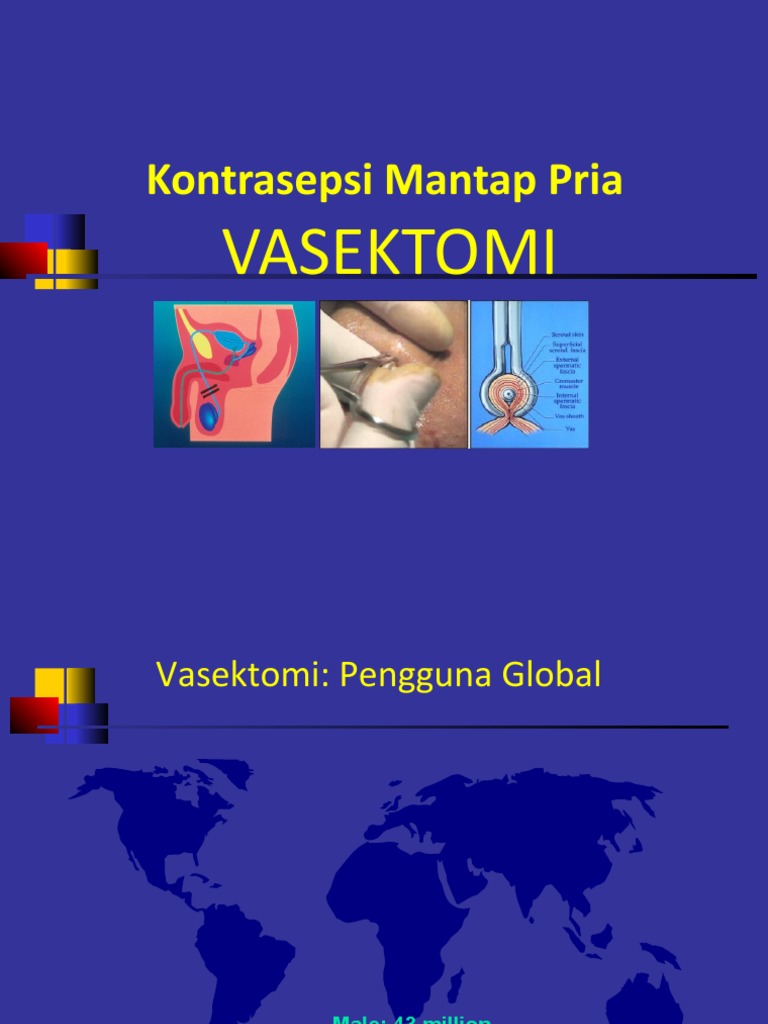 Vasektomi | PDF