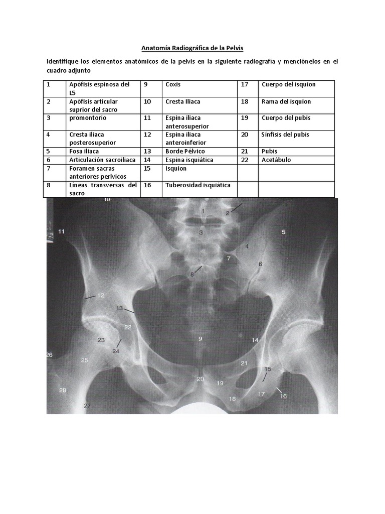 Radiografía de Pelvis: Anatomía Clave | PDF