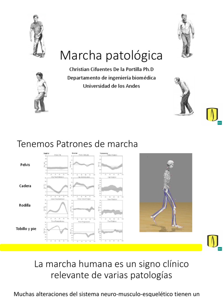 Clase 17-Marcha - Patologica | PDF | Rodilla | Enfermedad de Parkinson