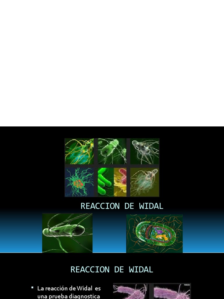 Reaccion de Widal 12 | PDF