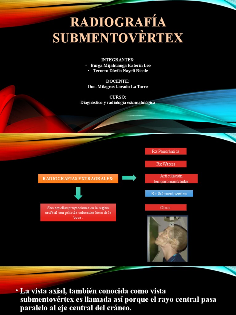 Diapositivas RX Submentovertex - Faltaaax2 | PDF | Cráneo