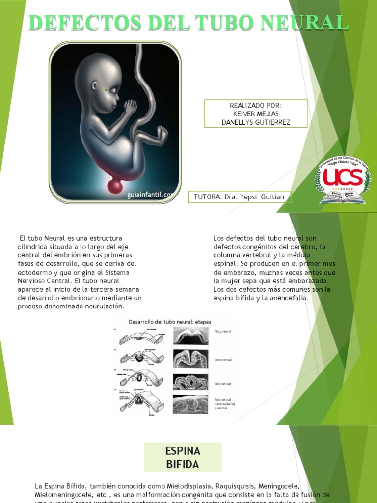 Defectos Del Tubo Neural | PDF | Especialidades Medicas | Enfermedades ...