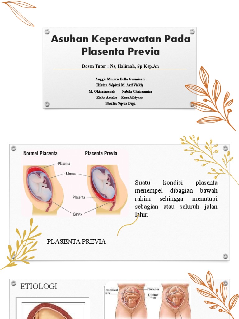 Tutor Plasenta Previa-1 | PDF