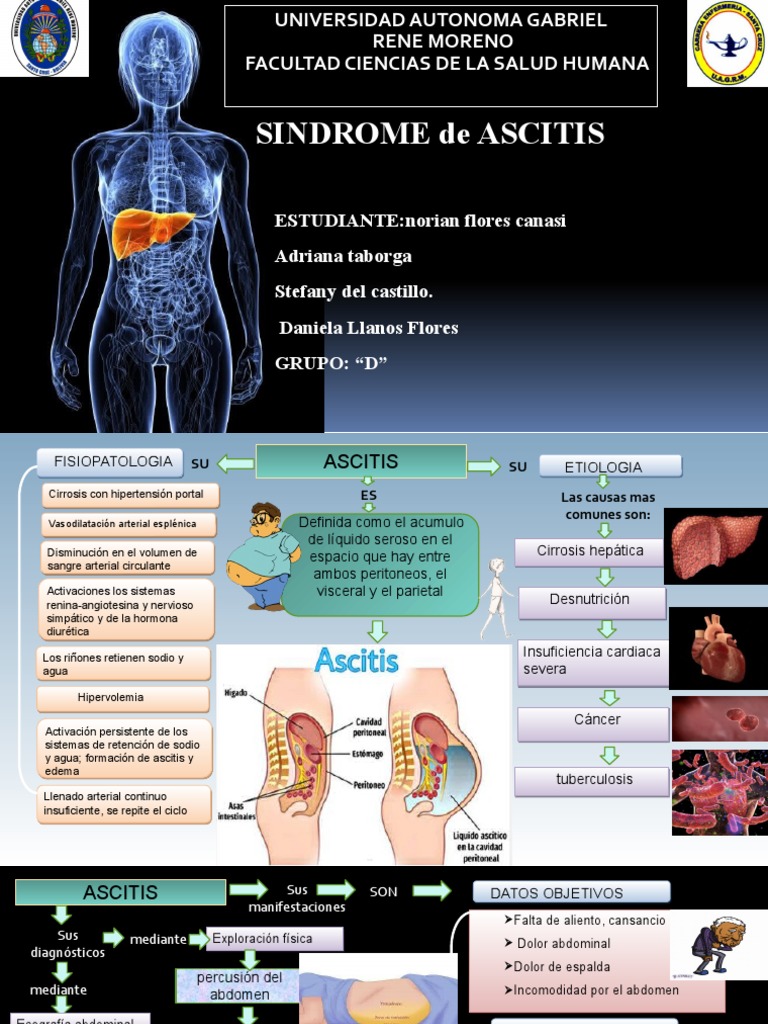 Diapositiva Ascitis | PDF | Especialidades Medicas | Medicina CLINICA