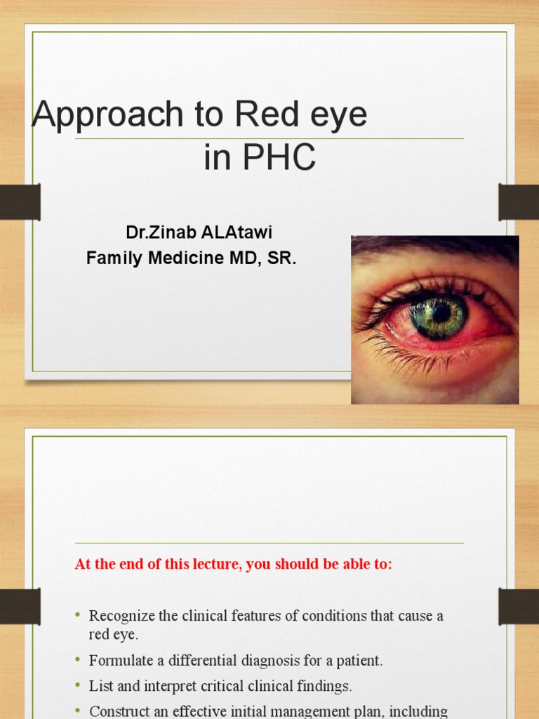 Approach To Red Eye in PHC: DR - Zinab Alatawi Family Medicine MD, SR ...