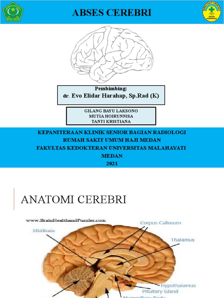Abses Cerebri | PDF