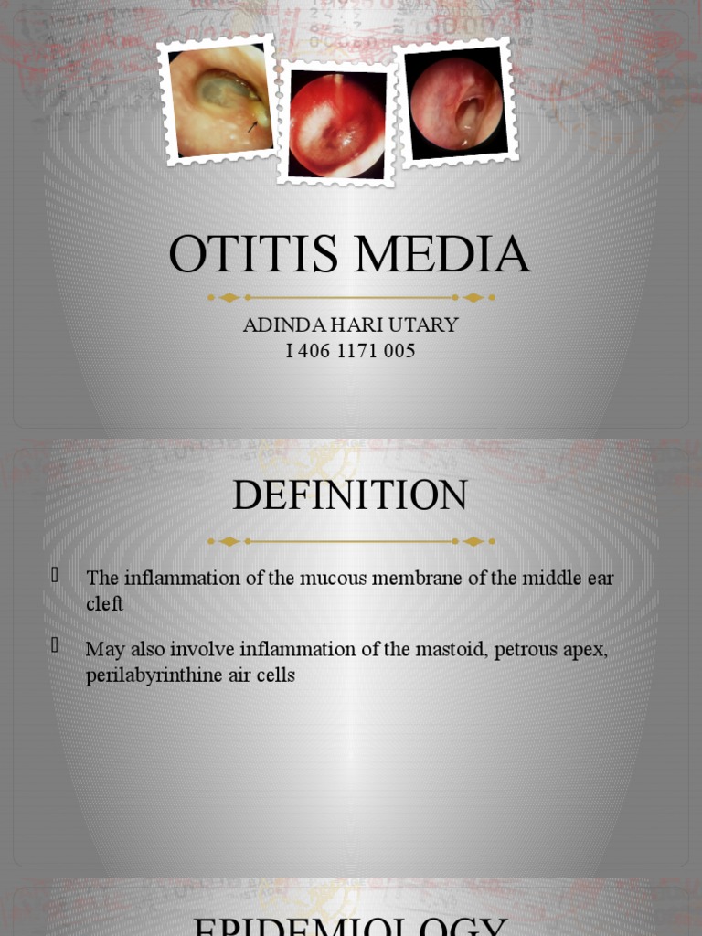 DT Otitis Media | PDF | Medical Specialties | Immunology