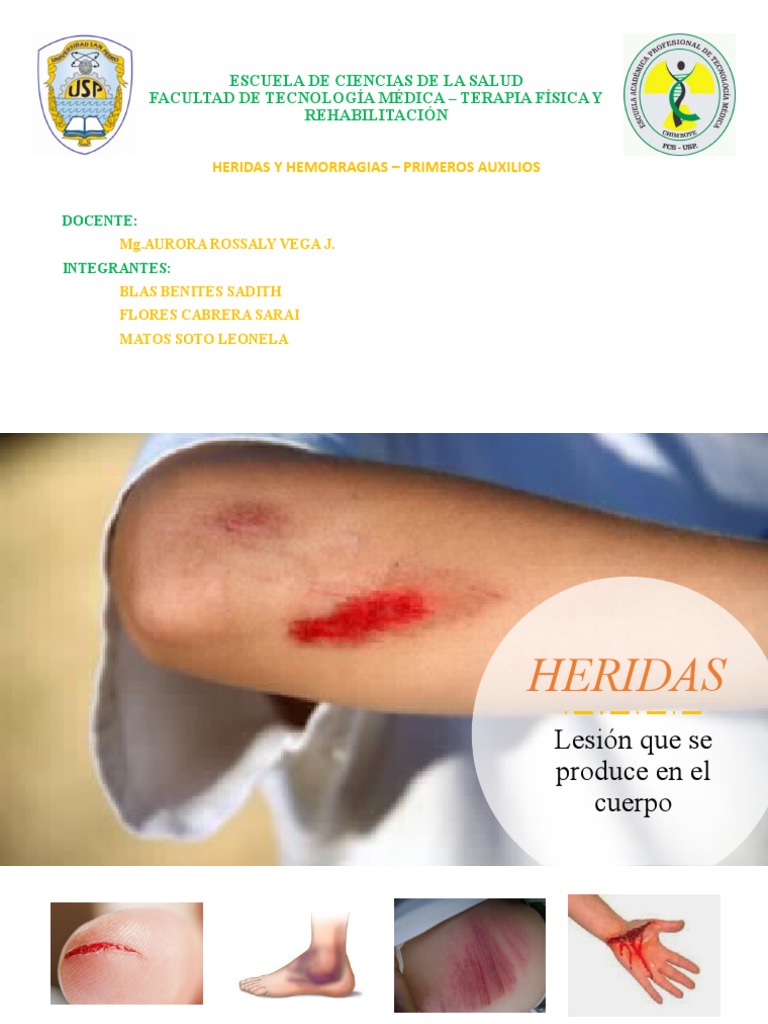 Heridas Y Hemorragias Pdf Primeros Auxilios Herida