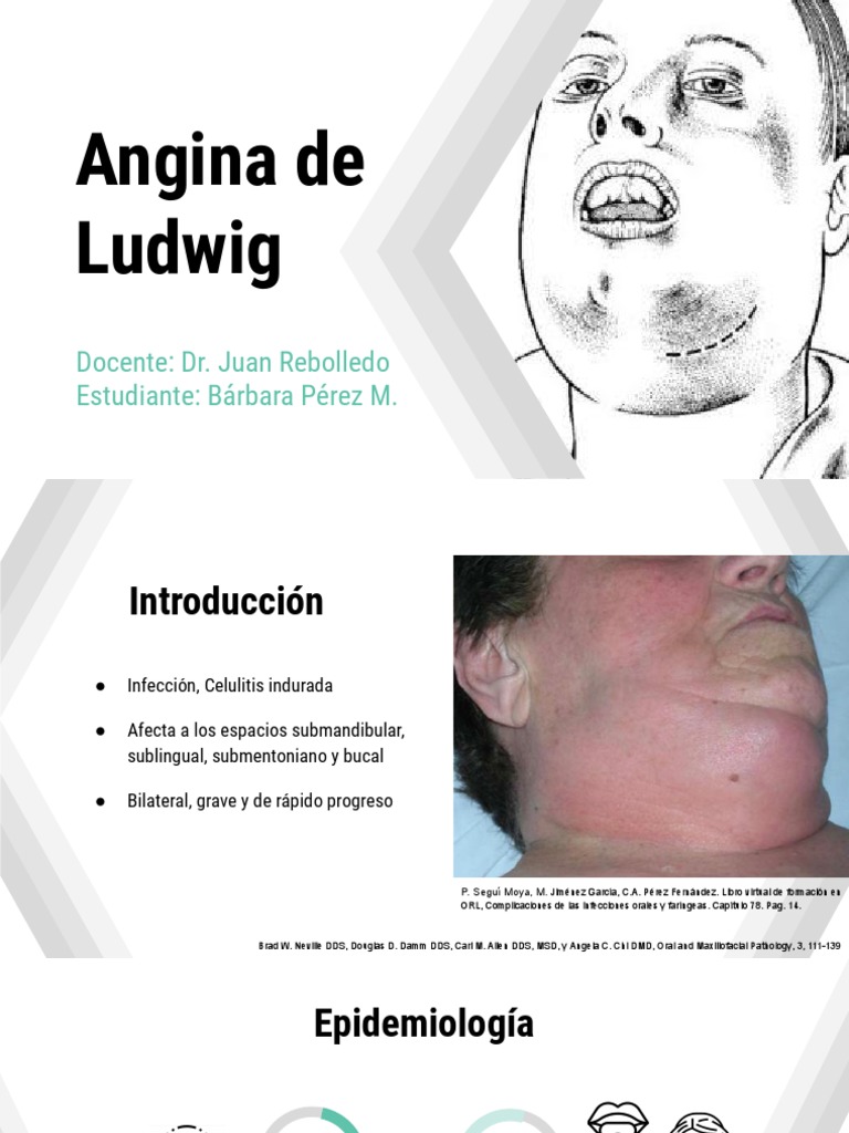Angina de Ludwig | PDF | Cuidado de la salud | Microbiología