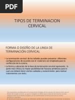 Tipos de Líneas de Terminación Dental | PDF | Dentadura postiza | Diente