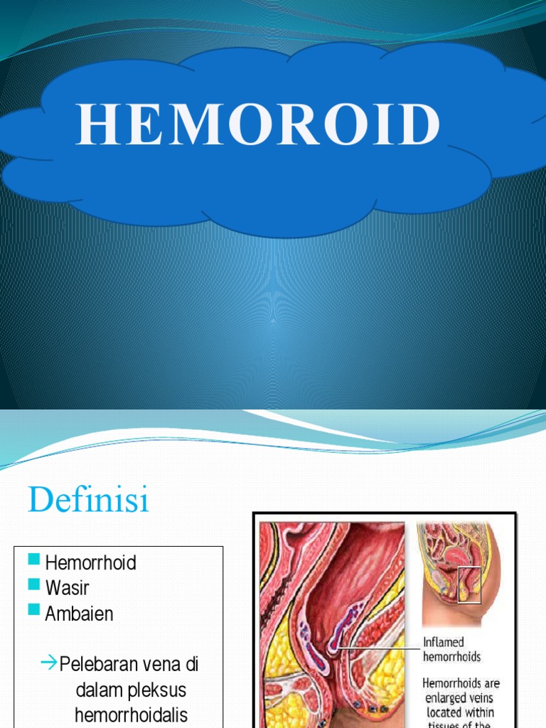 Hemoroid: Definisi dan Penanganan | PDF