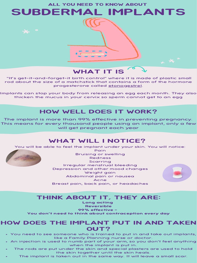 SUBDERMAL IMPLANT Infographic | PDF | Self-Improvement