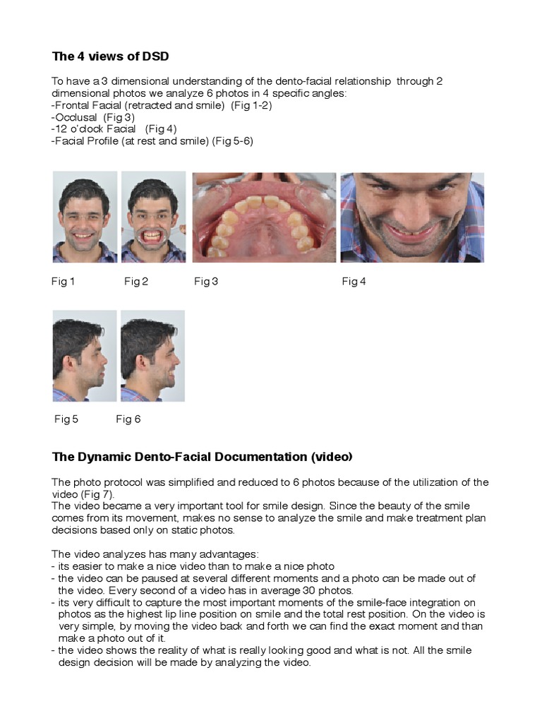 The 4 Views of DSD | PDF | Orthodontics | Dentistry