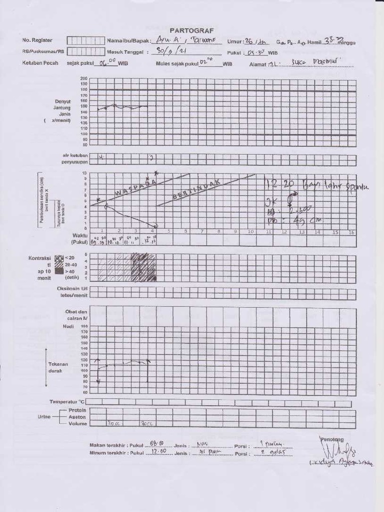 Partograf 1 | PDF