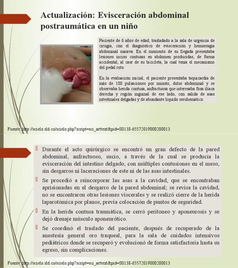 Actualización Evisceración Abdominal | PDF | Abdomen | Cirugía