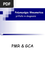 Management - Polymyalgia Rheumatica - CKS - NICE | PDF | Osteoporosis | Medical Specialties