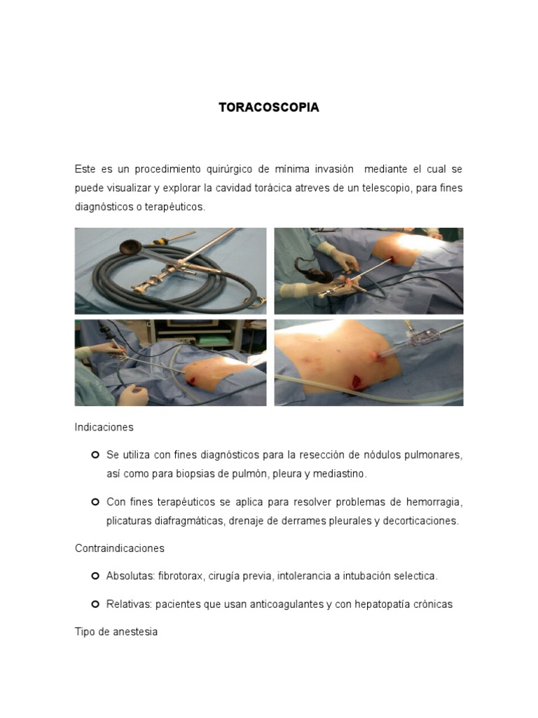 Procedimiento de Toracoscopia Quirúrgica | PDF | Cirugía | Biopsia