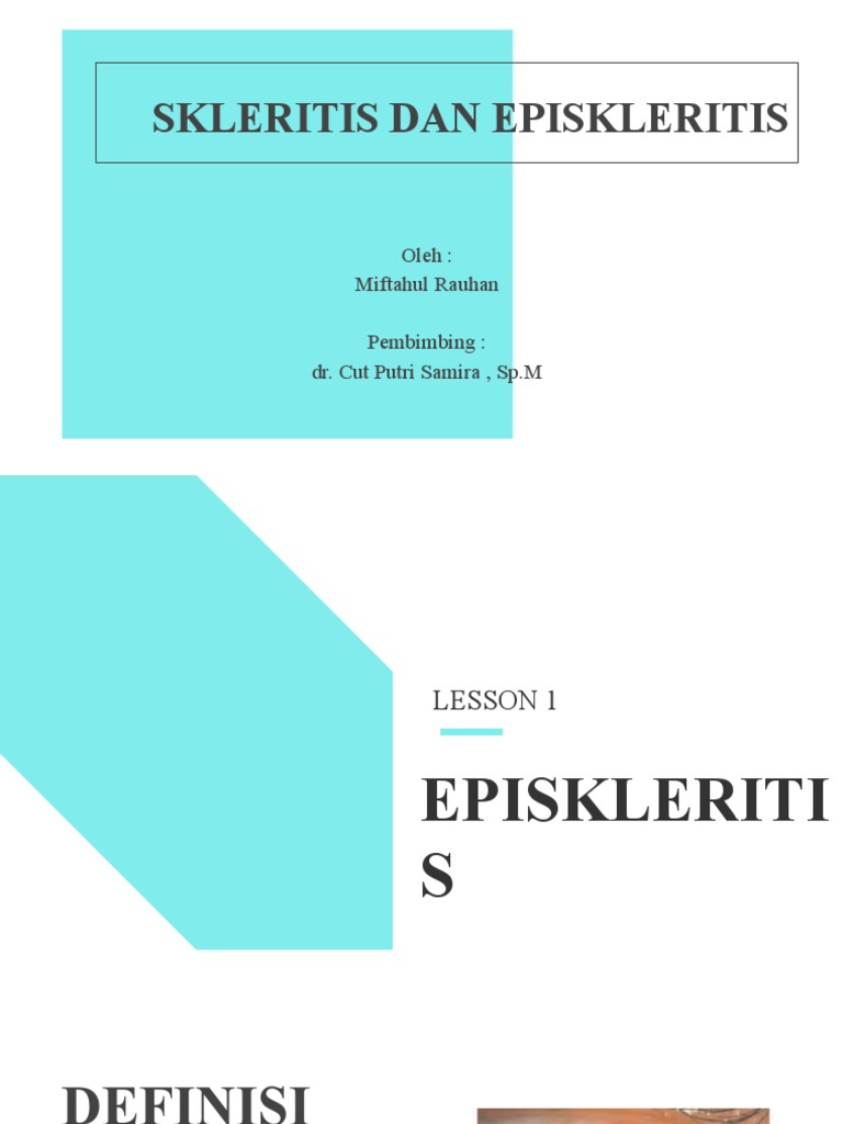 Slide Skleritis & Episkleritis | PDF | Sains & Matematika