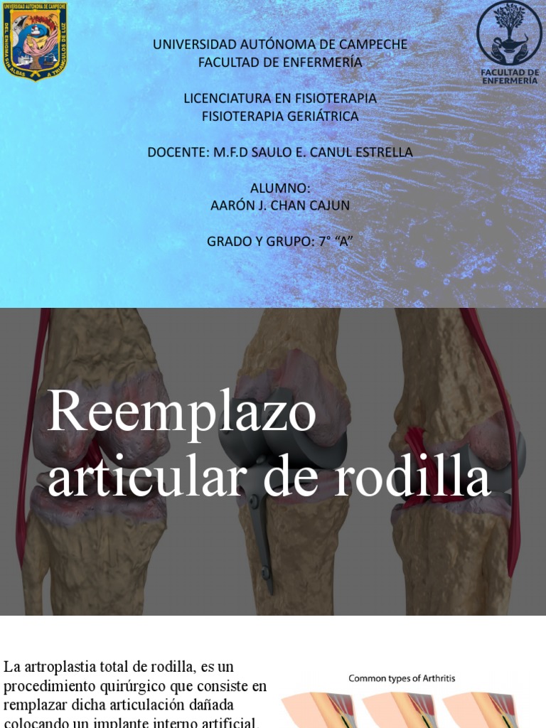 Reemplazo de Rodilla | PDF | Rodilla | Enfermedades y trastornos
