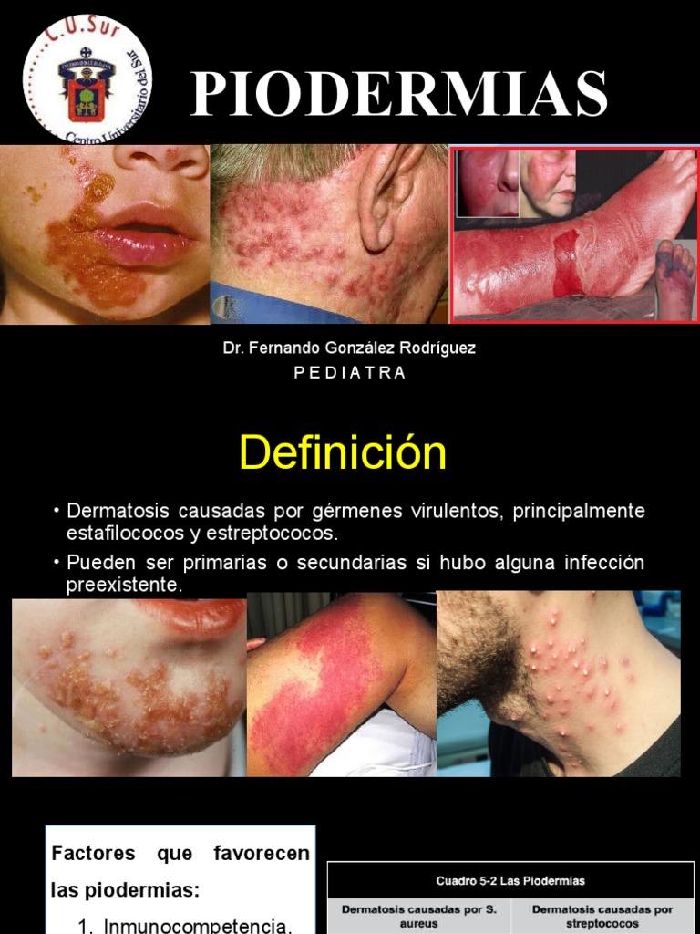 Piodermias: clasificación, diagnóstico y tratamiento de las infecciones ...