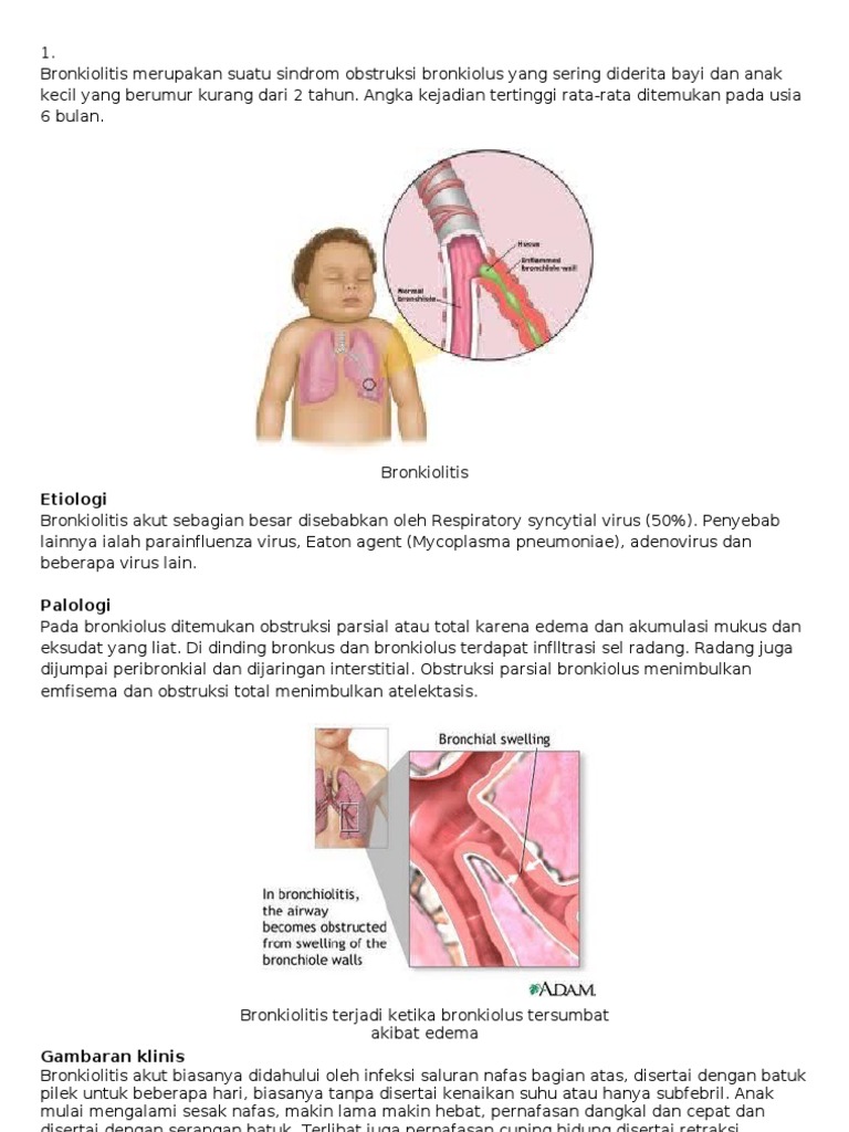 Bronkiolitis Merupakan Suatu Sindrom Obstruksi Bronkiolus Yang Sering ...