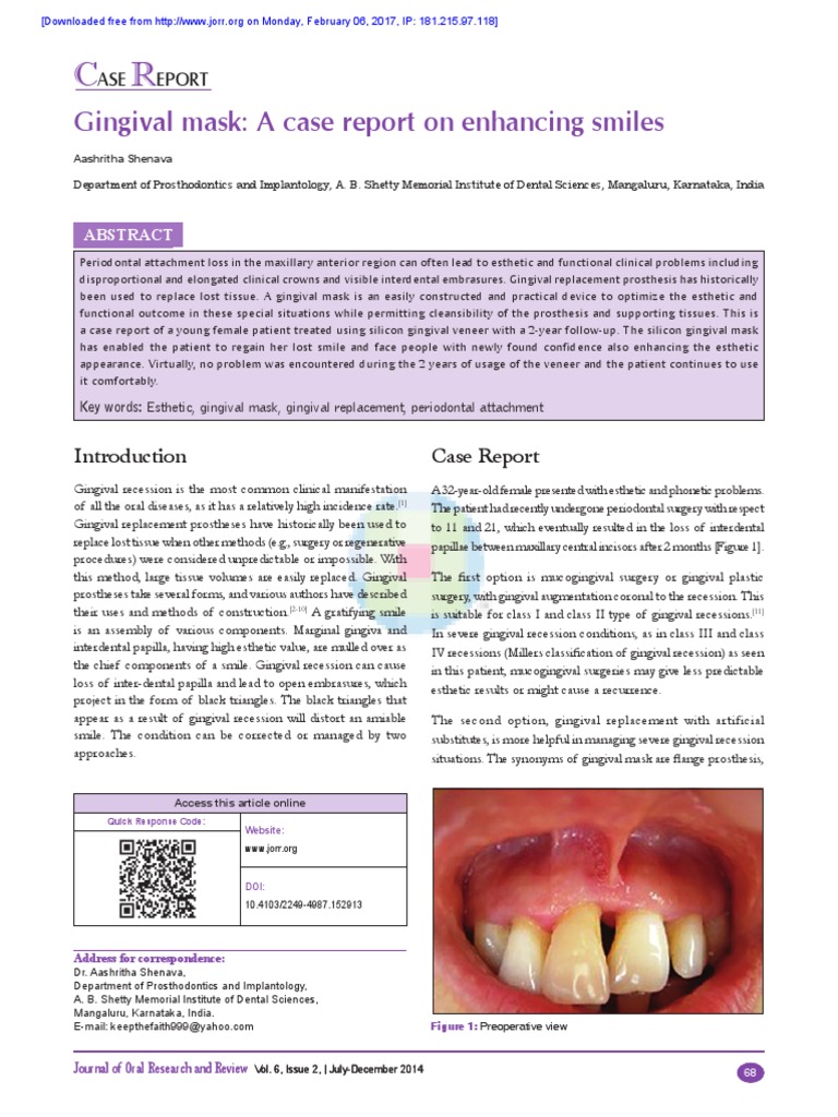 Gingival Mask: A Case Report On Enhancing Smiles: ASE Eport | PDF ...