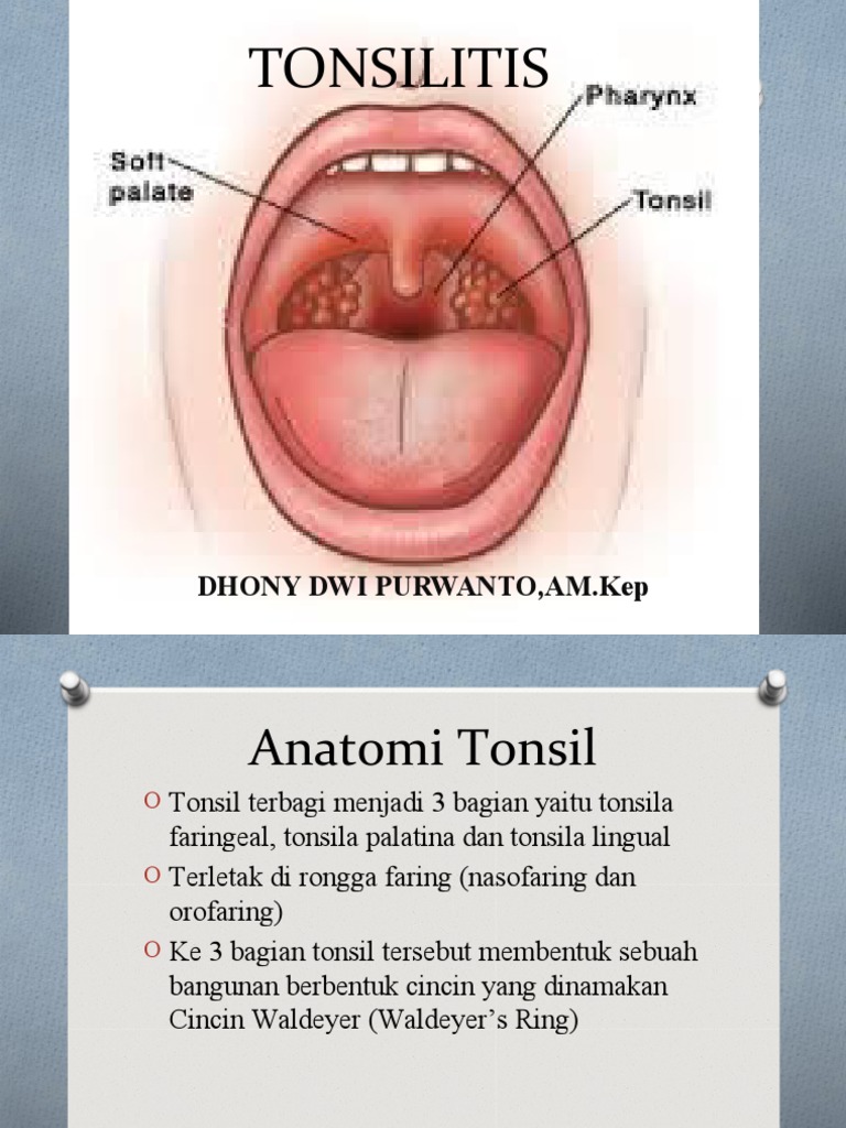 TONSIL | PDF