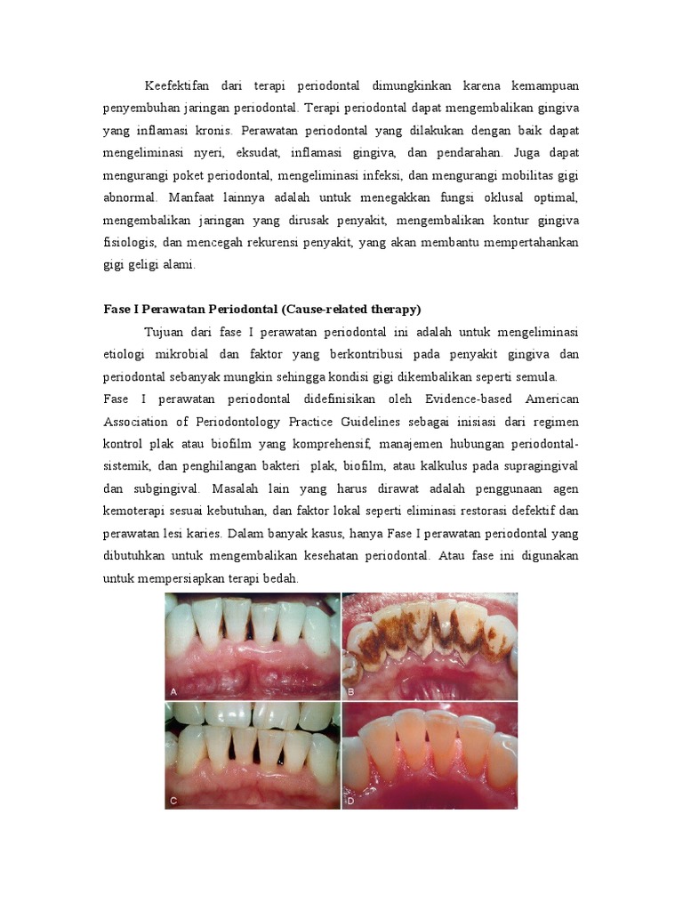 Fase I Perawatan Periodontal | PDF | Pengembangan Diri