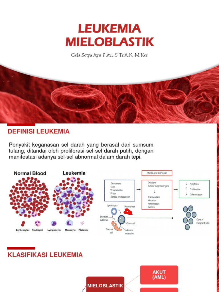 Ciri dan Definisi Leukemia Mieloblastik | PDF