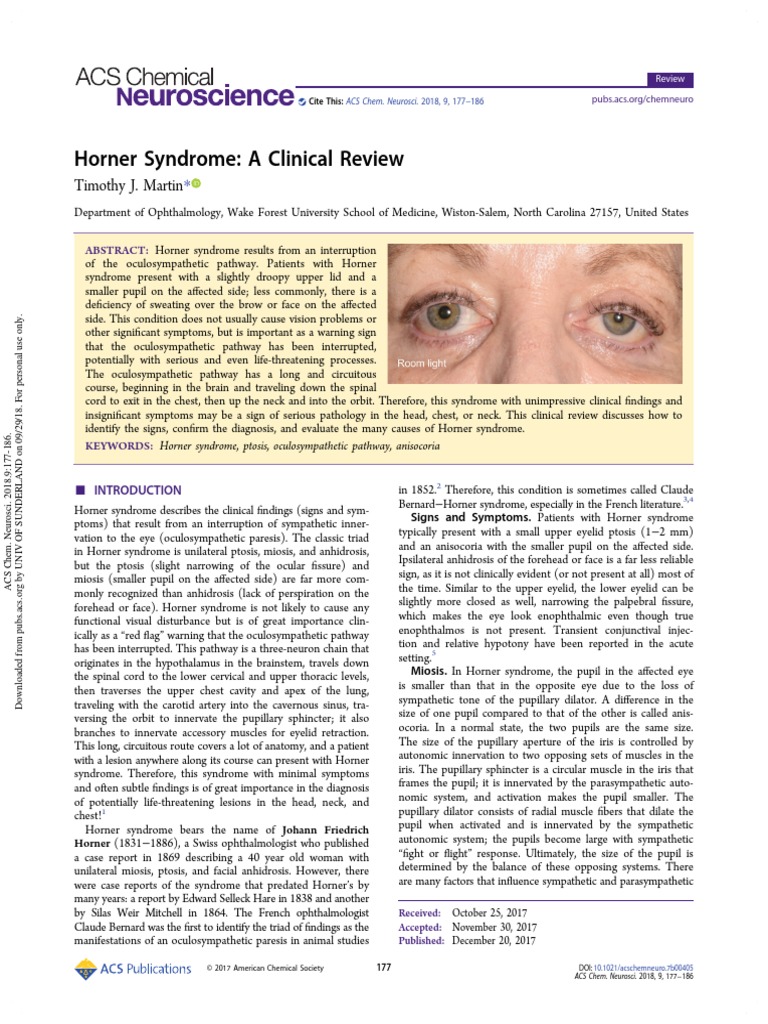 Horner Syndrome: A Clinical Review: Timothy J. Martin | PDF | Chemical ...