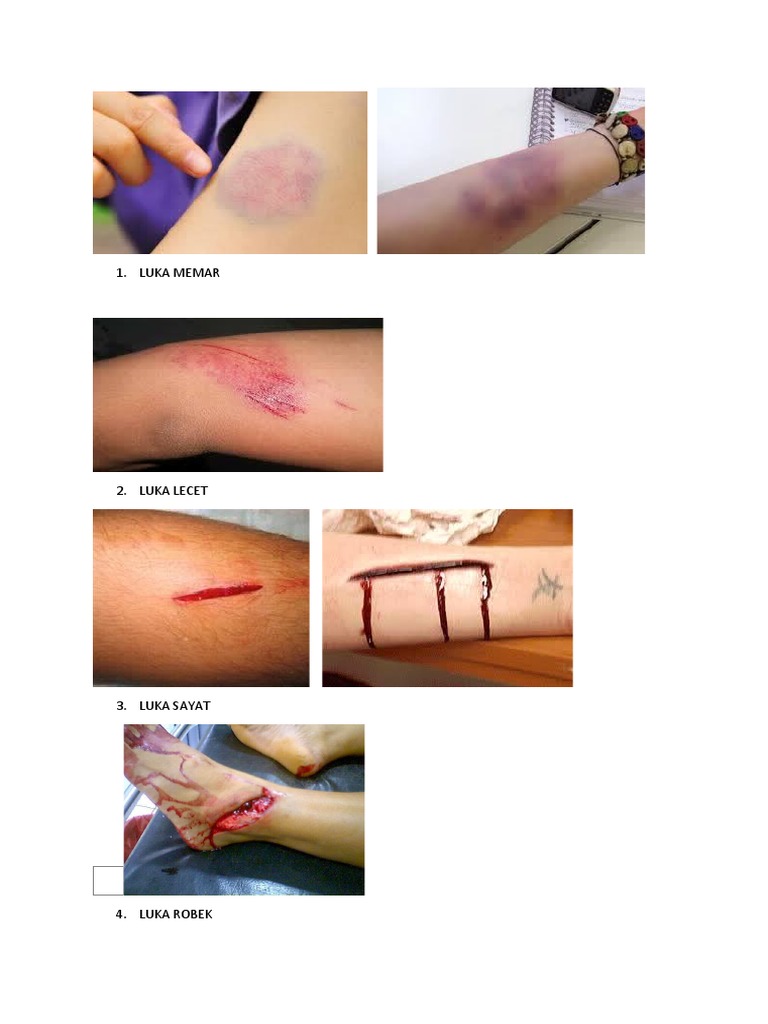 Gambar Jenis Luka | PDF