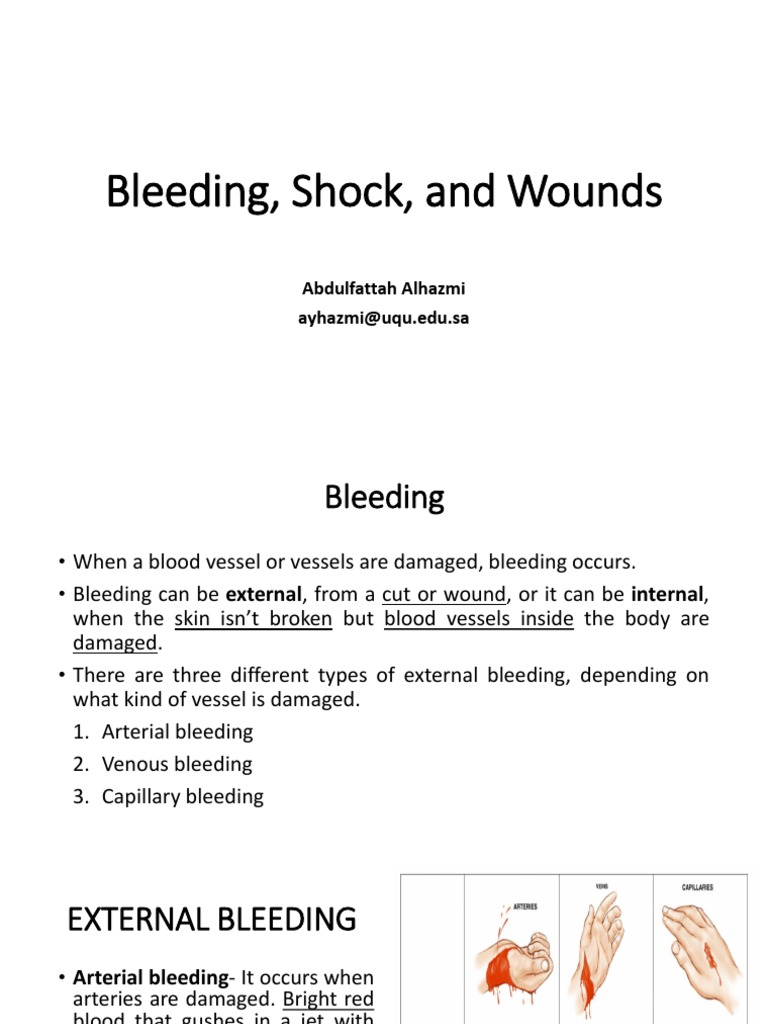 Bleeding 2021 | PDF | Wound | Bleeding