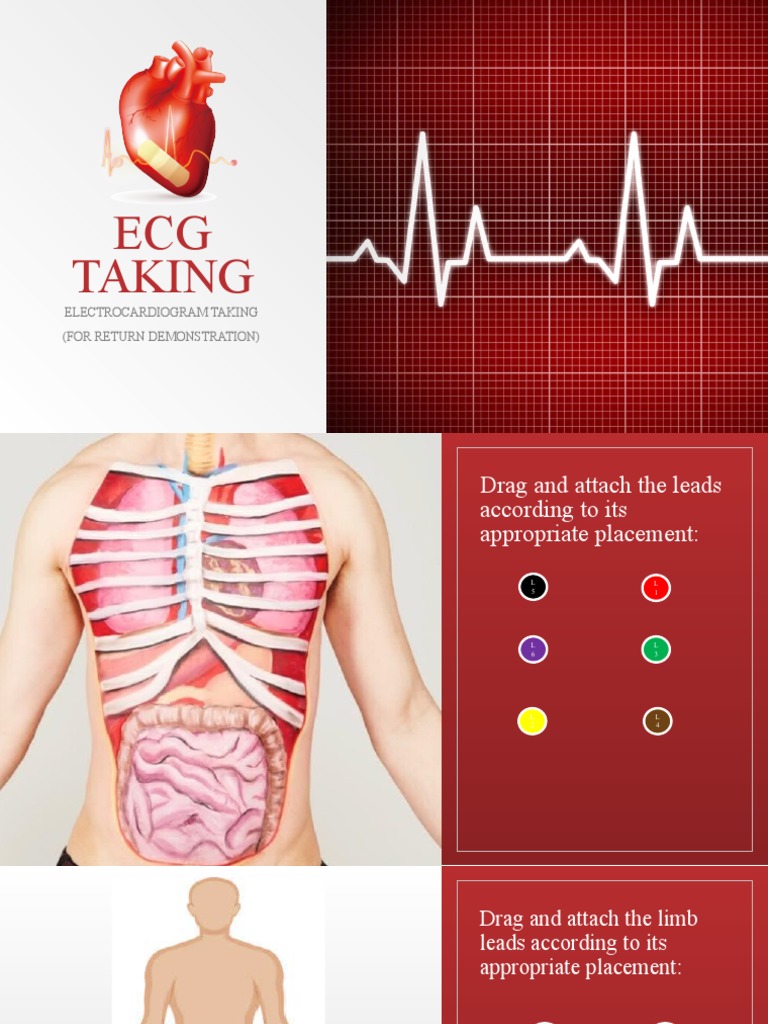 ECG Taking: Electrocardiogram Taking (For Return Demonstration) | PDF