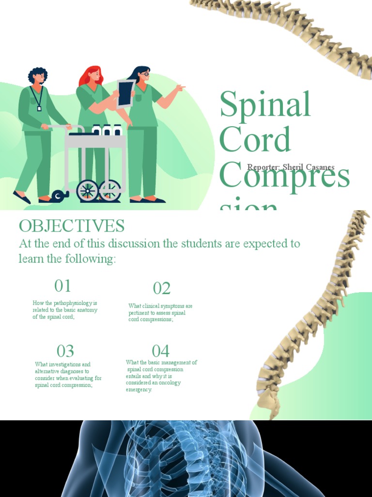 Spinal Cord Compression | Download Free PDF | Physical Therapy | Spinal ...