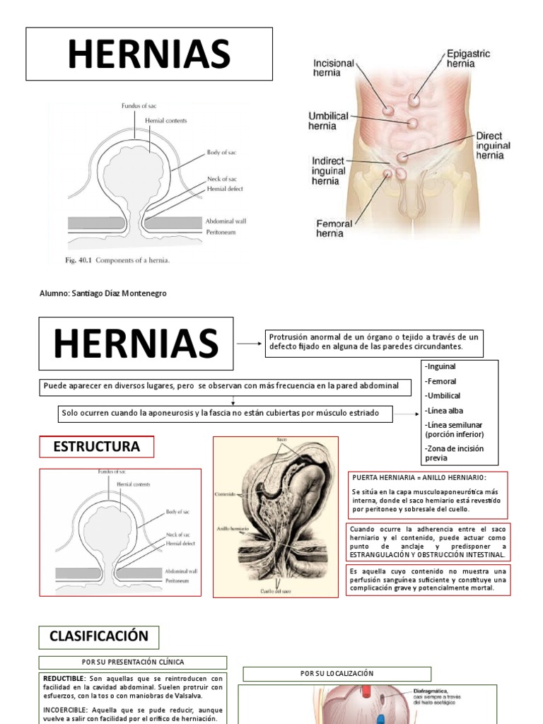 Hernias | Descargar gratis PDF | Abdomen | Enfermedades y trastornos