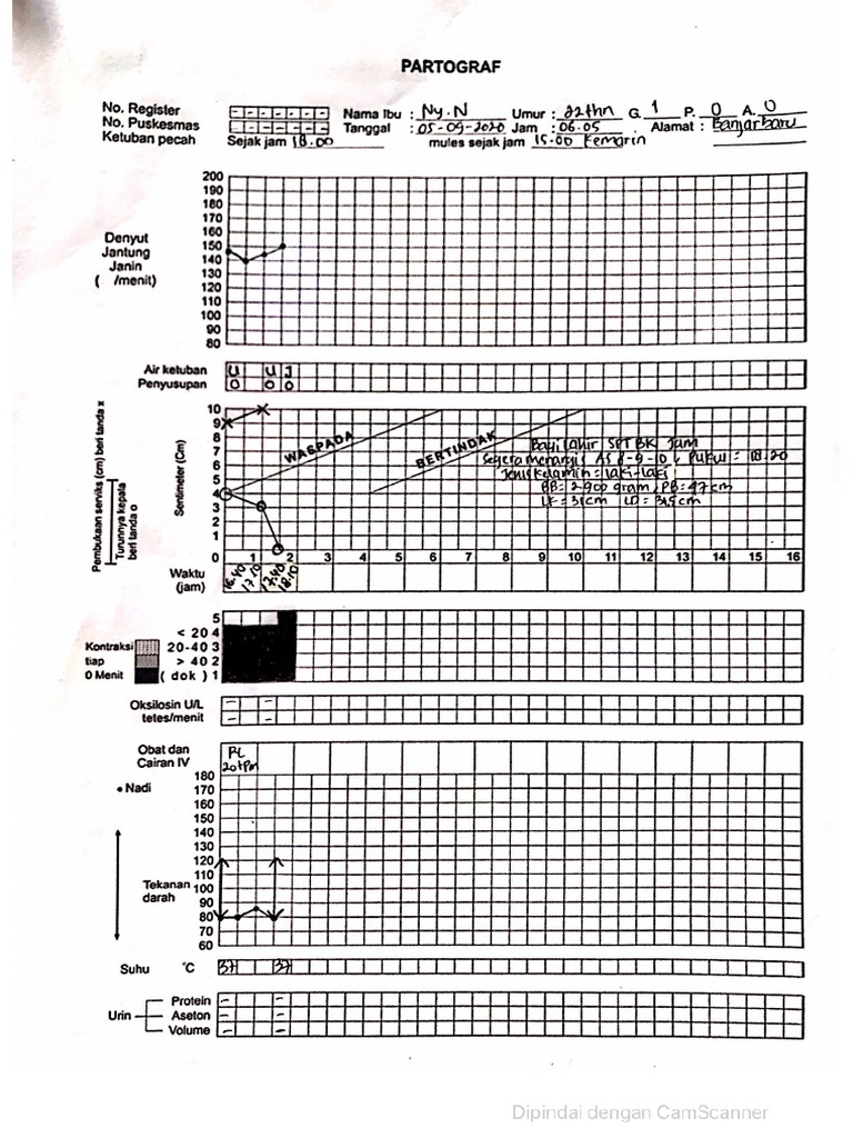Aulia Rahmah - P07124118173 - Partograf Pengisian Terbaru | PDF