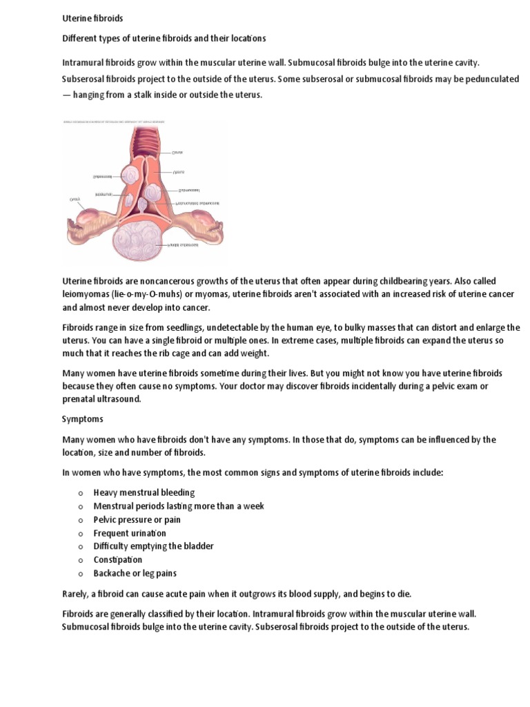 Understanding Uterine Fibroids | PDF | Uterus | Pregnancy