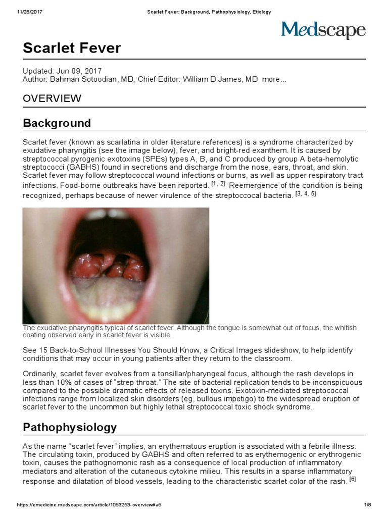 Scarlet Fever - Background, Pathophysiology, Etiology | PDF ...
